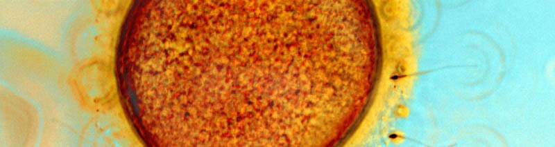 Cambridge spin-out BlueGnome acquired by Illumina – Cambridge Enterprise