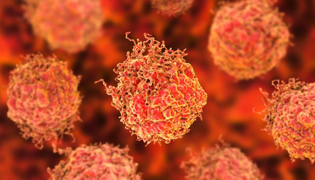 Cambridge Enterprise licenses unique new device for cancer diagnosis ...