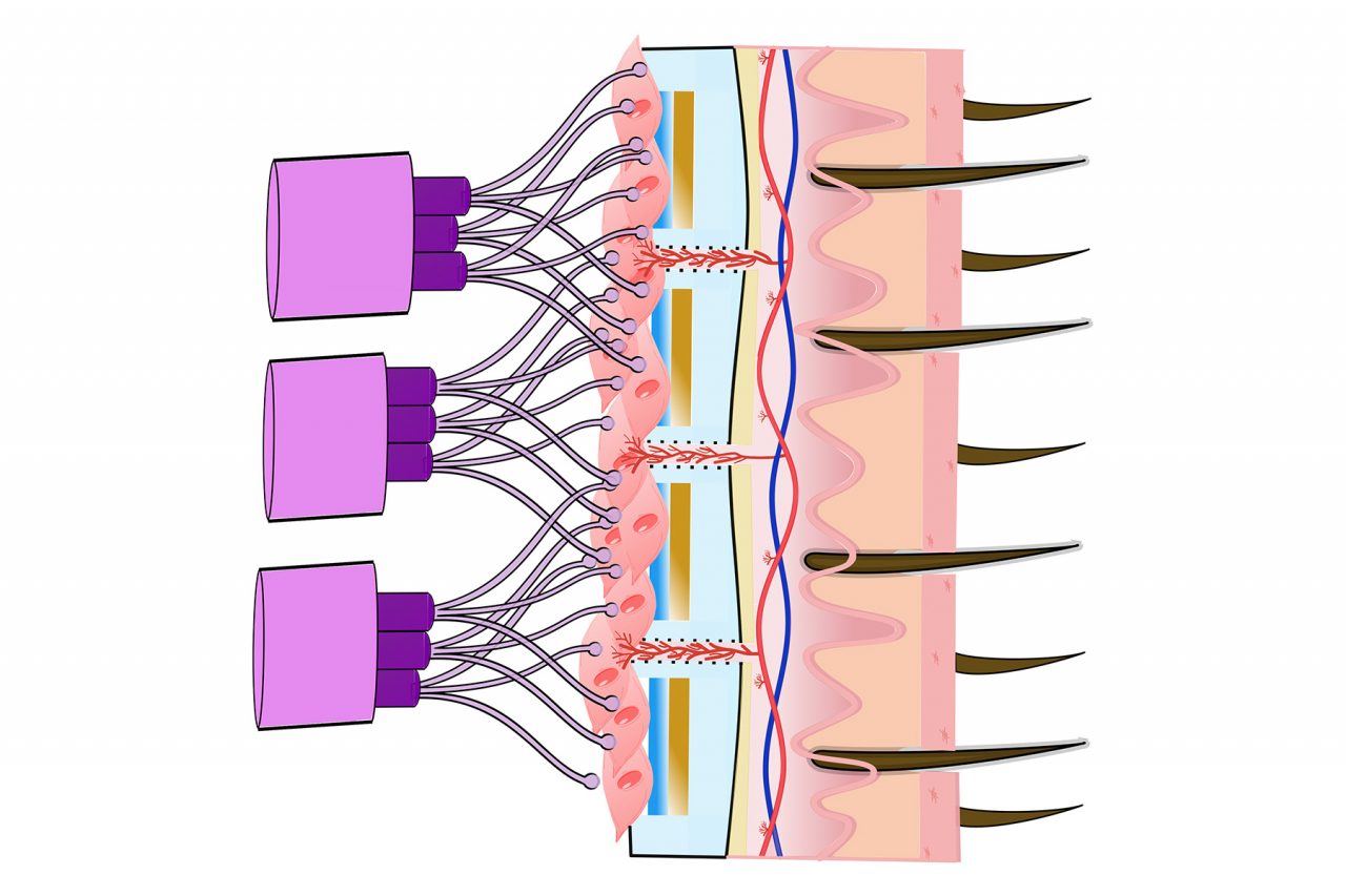 ‘Biohybrid’ device could restore function in paralysed limbs