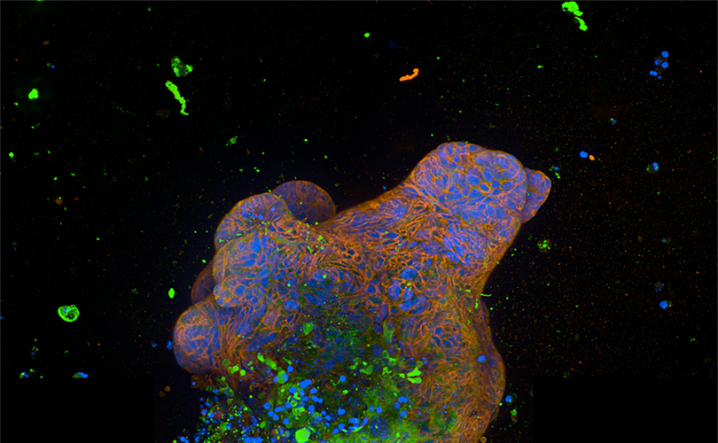 Lab-grown ‘mini-guts’ could help in development of new and more ...