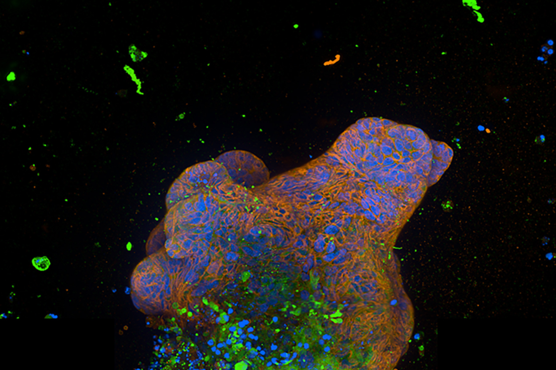 Lab-grown ‘mini-guts’ could help in development of new and more ...