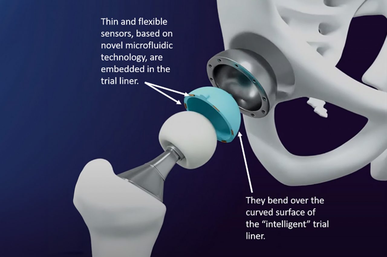 Cambridge team secures Product Development Award for pioneering hip ...