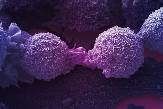 Astex Pharmaceuticals: Pioneering fragment-based drug discovery ...