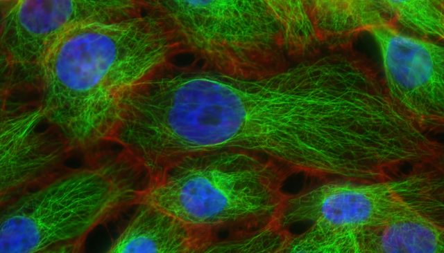 Astex Pharmaceuticals: Pioneering fragment-based drug discovery ...